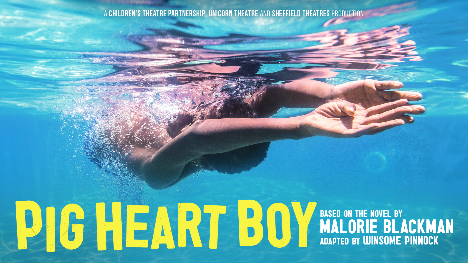 Pig Heart Boy - Uncover Liverpool